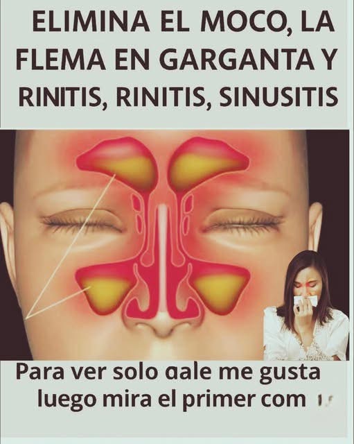 Remedios Caseros para Eliminar Moco y Flema en la Garganta y Nariz - DocMod